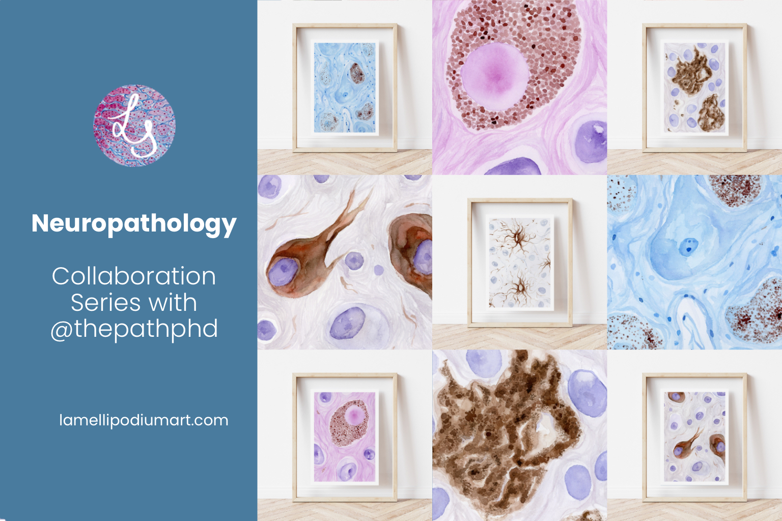 2022 Neuropathology - Painting Series - LamellipodiumArt